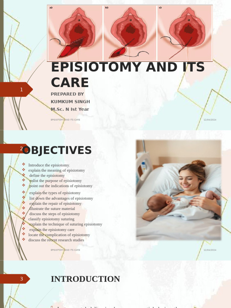 Episiotomy Care and Techniques | PDF | Surgical Suture | Childbirth