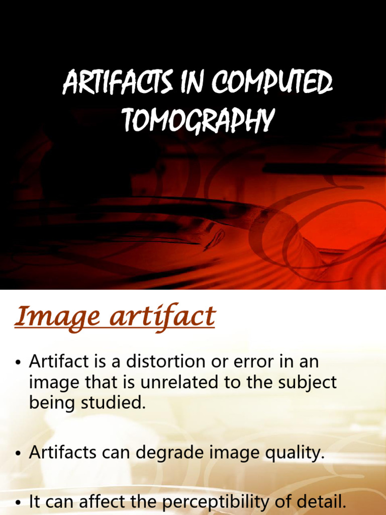 Ct artifacts | PDF | Ct Scan | X Ray