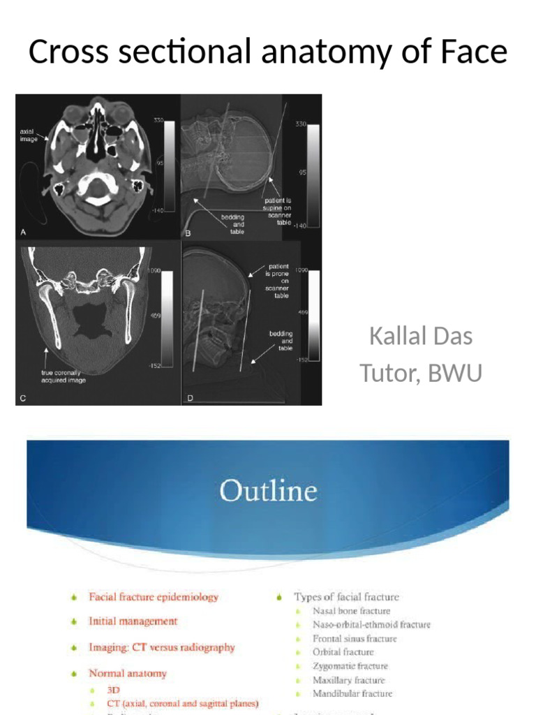CT Imaging of Facial Anatomy | PDF