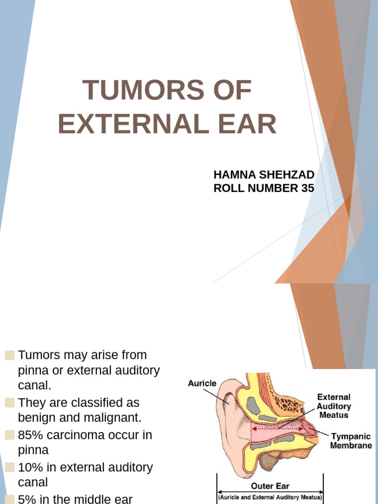 Tumor of External Ear | PDF | Melanoma | Ear