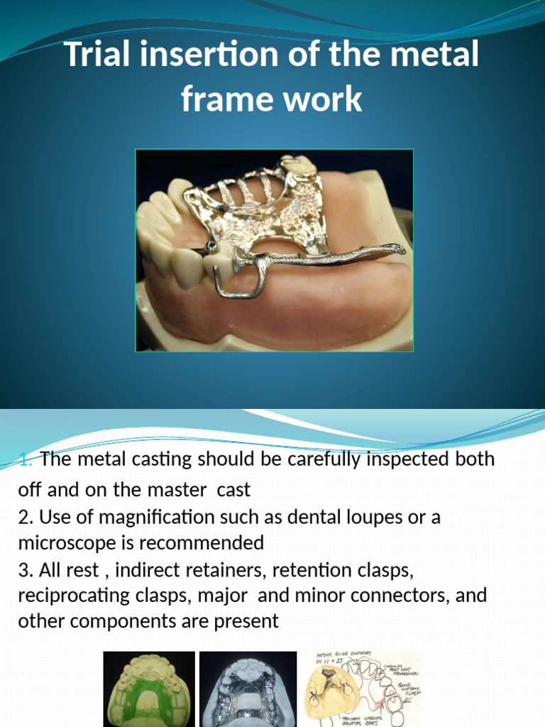 Metal Try In | PDF | Dentures | Dentistry Branches