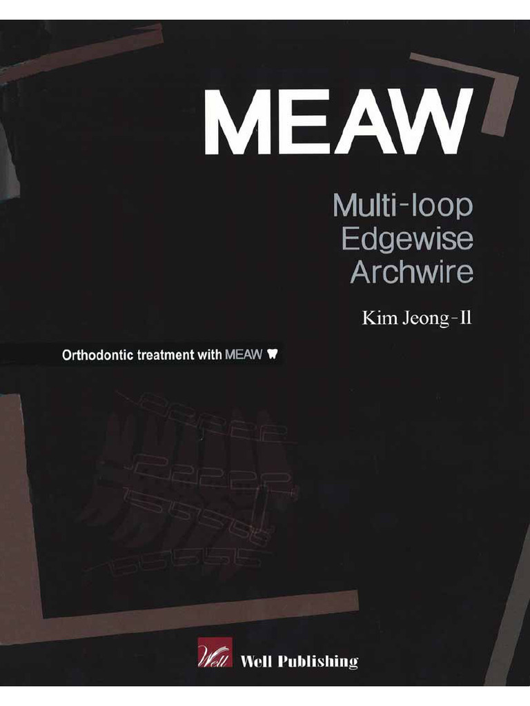 MEAW (Multi-Loop Edgewise Archwire) Orthodontic Treatment With MEAW | PDF
