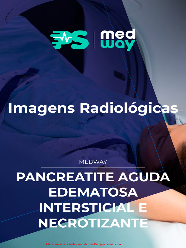 Pancreatite Aguda Edematosa Intersticial e Necrotizante | PDF | Doenças ...
