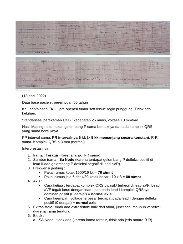 Latihan Interpretasi EKG 13 April 2022 (1) | PDF