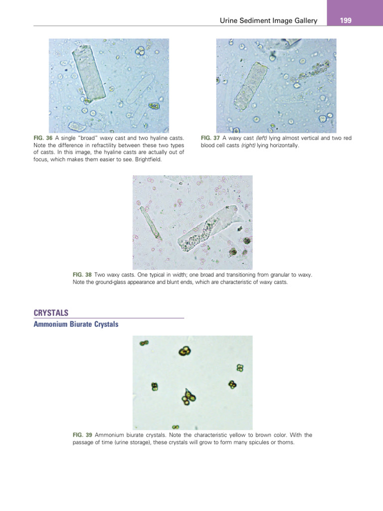 Fundamentals of Urine and Body Fluid Analysis (Fourth Edition) Pages ...