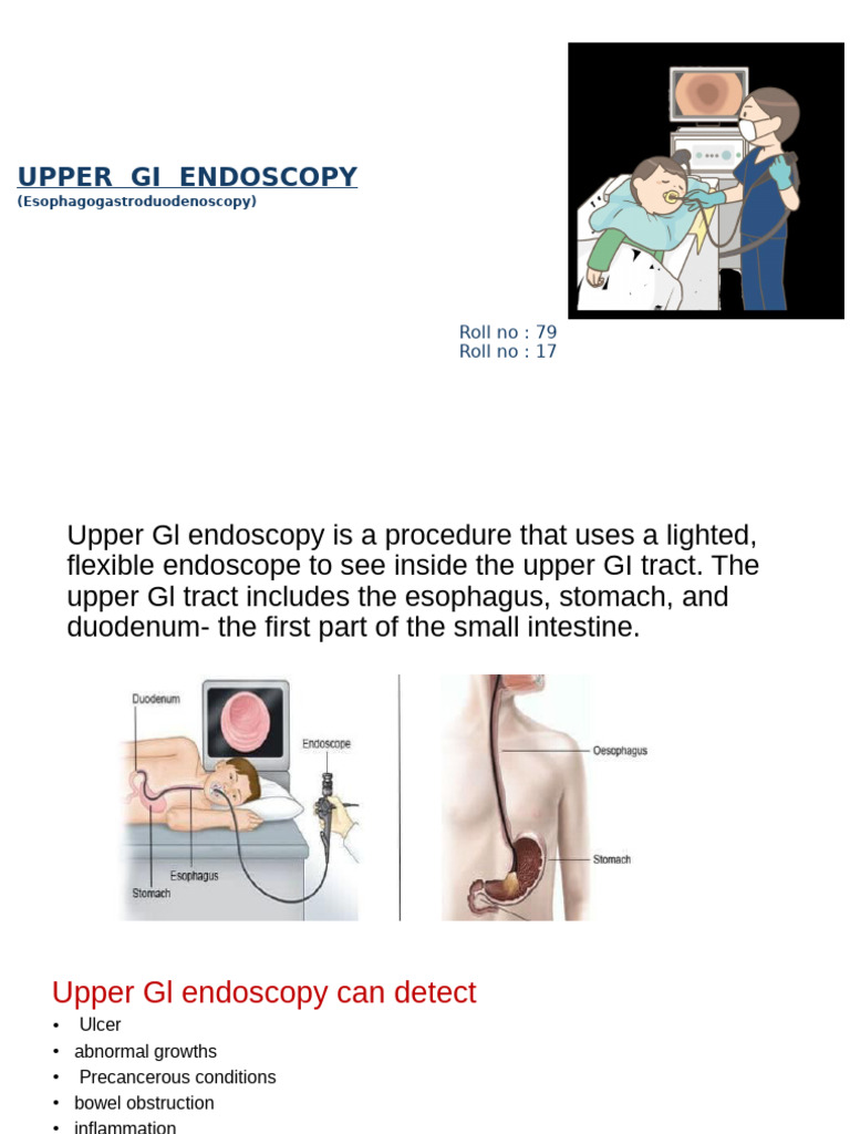Upper GI Endoscopy Overview | PDF | Endoscopy | Diseases And Disorders