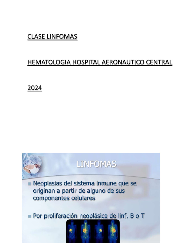 Linfomas Hac 2024 | PDF