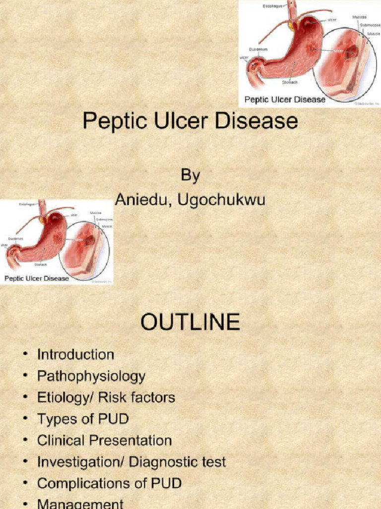 Peptic Ulcer 57689431 | PDF