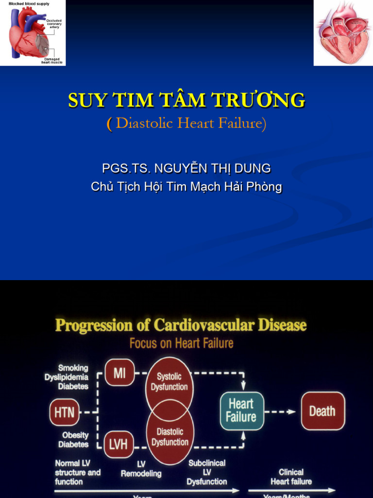 File - SUY TIM TAM TRUONG - Dung | PDF