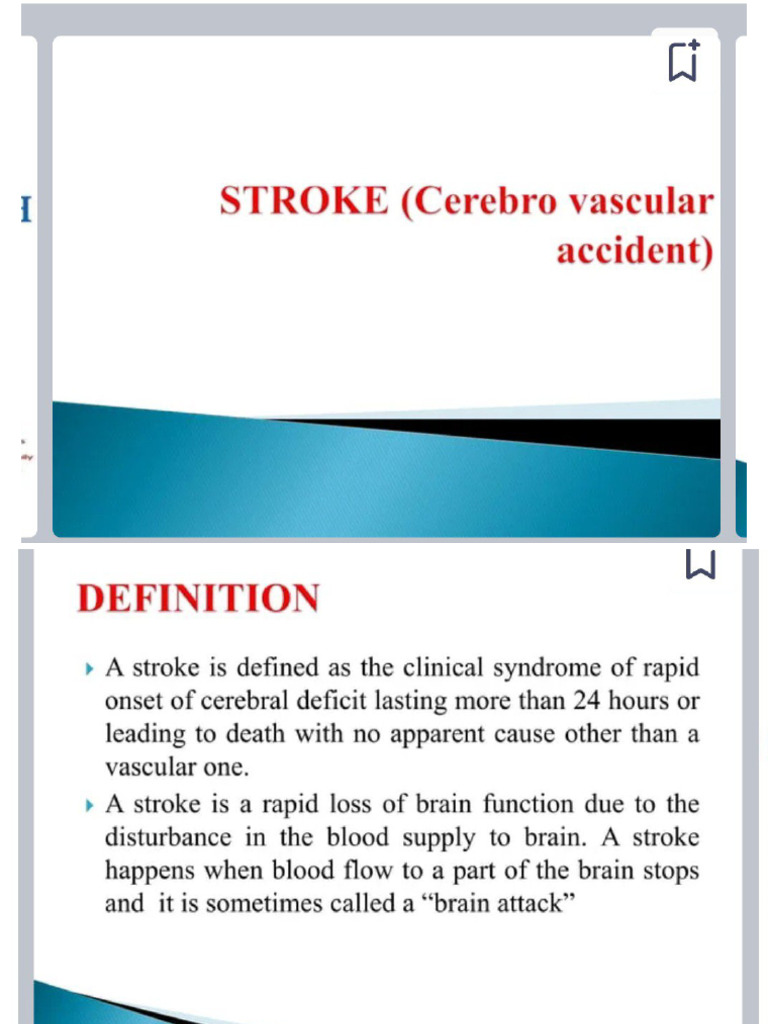 Stroke | PDF