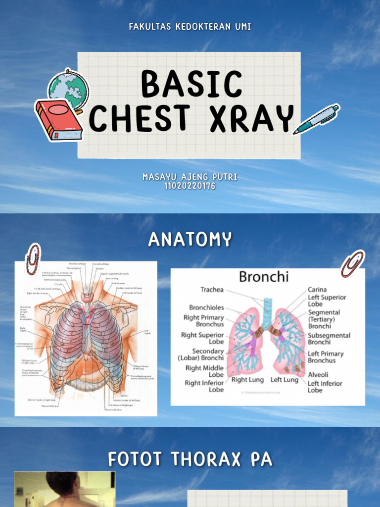 Chest x ray | PDF