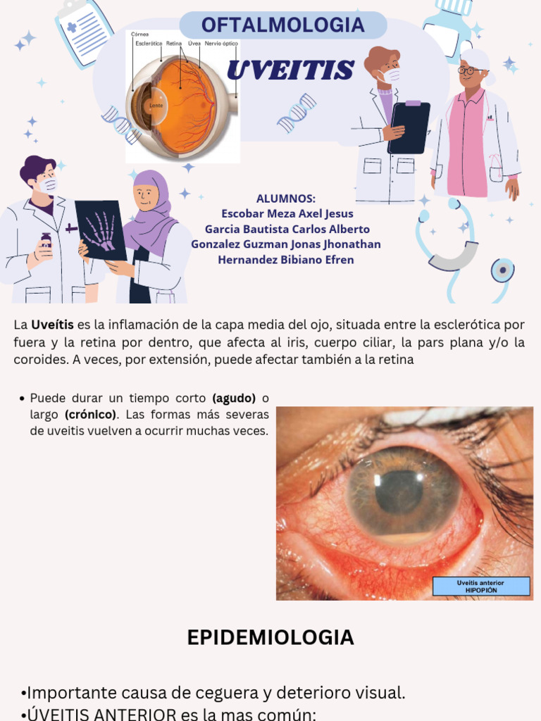 UVEITIS | PDF | Inflamación | Percepción visual