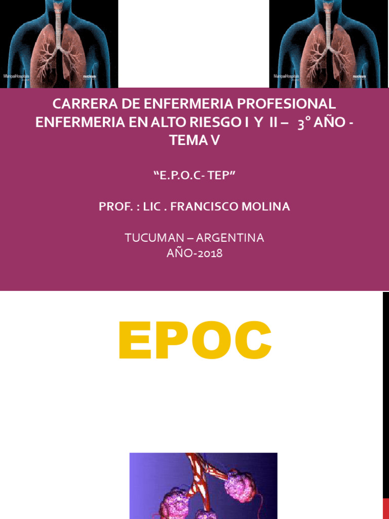Tema 5 EPOC TEP | PDF | Medicina CLINICA | Enfermedades y trastornos