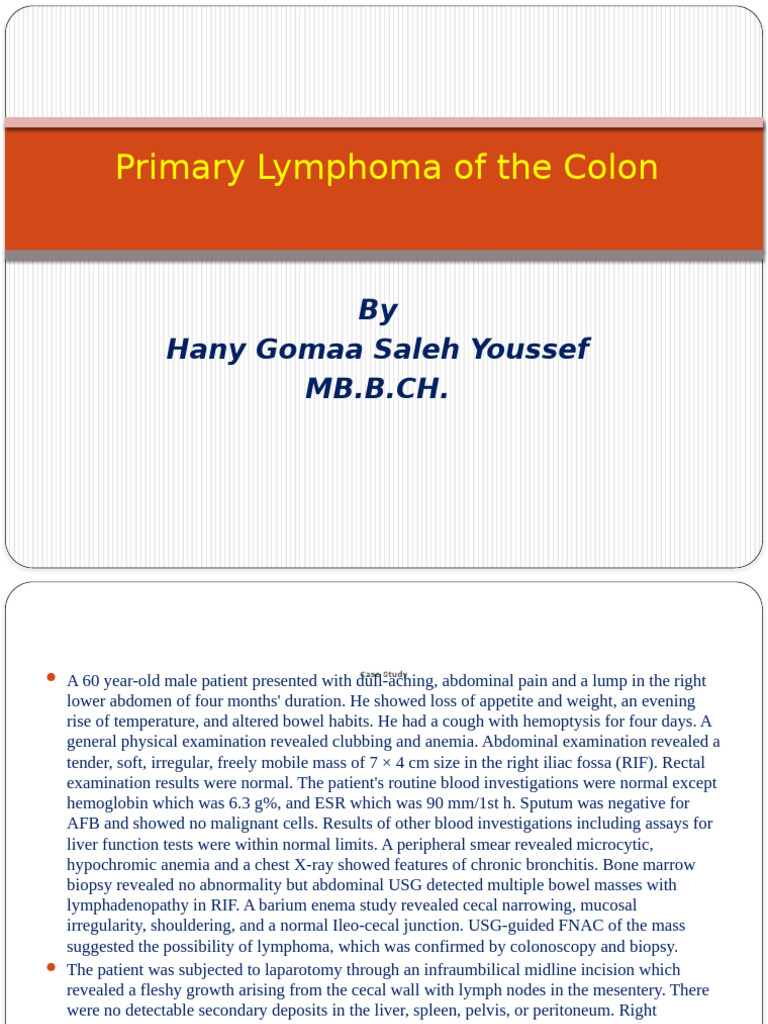 Primary Lymphoma of The Colon | PDF | Colorectal Cancer | Lymphoma
