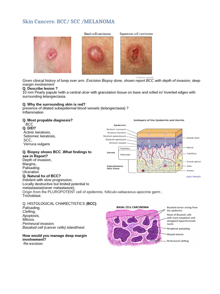 Understanding Skin Cancers: BCC, SCC, Melanoma | PDF | Melanoma | Skin ...