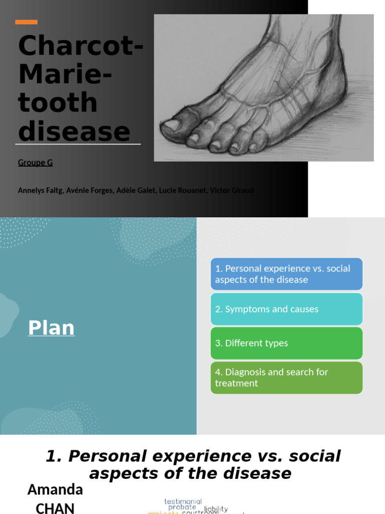 Charcot Marie Tooth Diapo 2 | PDF