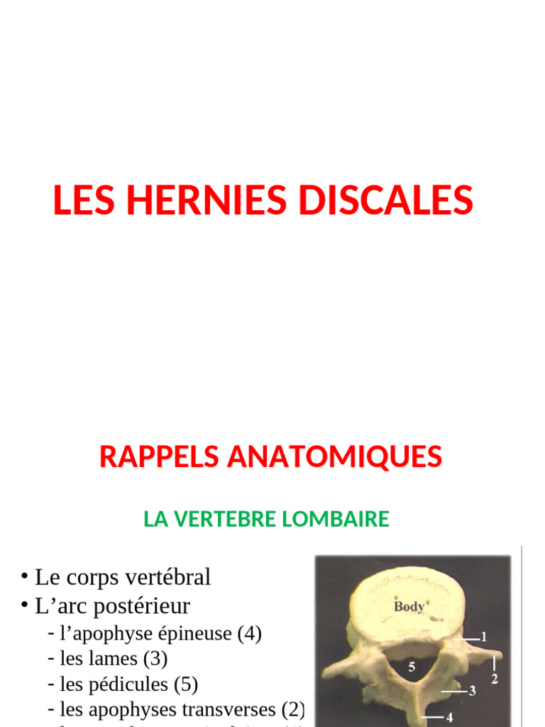 hernie discale | PDF | Vertèbre | Système nerveux