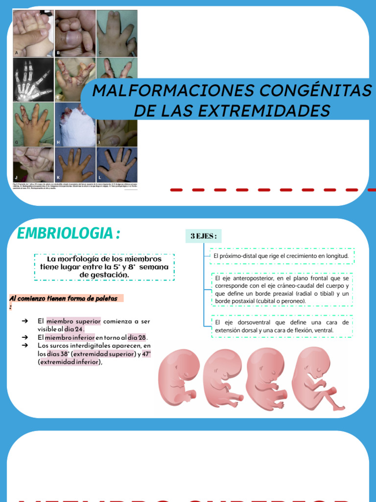 Malformaciones Congenitas Rostro y Extremidades | PDF | Mano | Pie