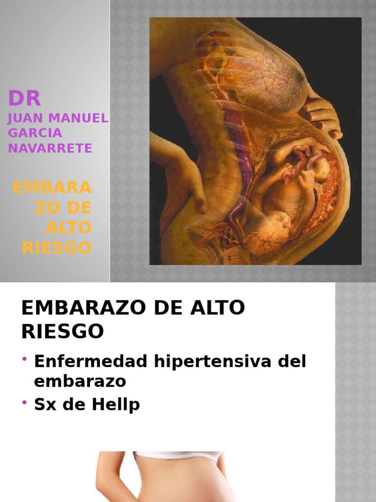 Enfermedad Hipertensiva Del Embarazo | PDF | El embarazo | Hipertensión