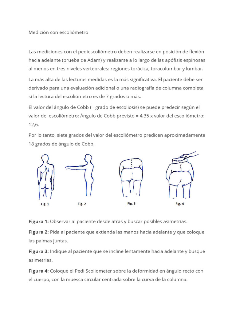 Cómo utilizar el Pedi-Scoliometer.docx | PDF