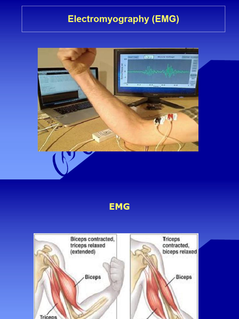 15 EMG | PDF | Electromyography | Muscle Contraction