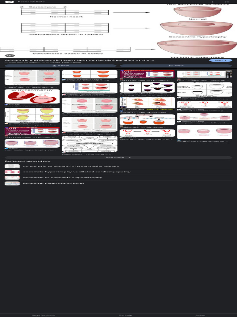 Searchq Eccentric+hypertrophy+meaning&sca Esv 518c046ebb1e337c&sca Upv ...