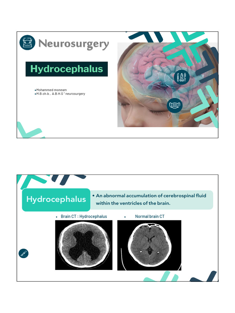 L4 Hydrocephalus | PDF | Cerebrospinal Fluid | Clinical Medicine