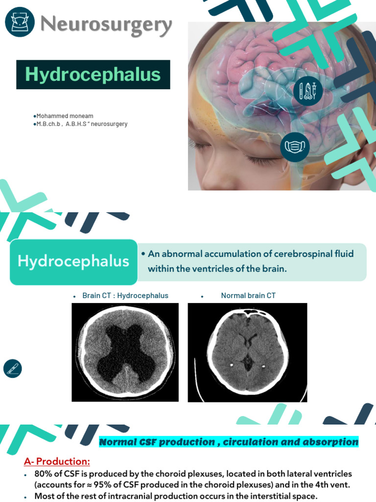 L4-Hydrocephalus | PDF | Cerebrospinal Fluid | Medical Specialties