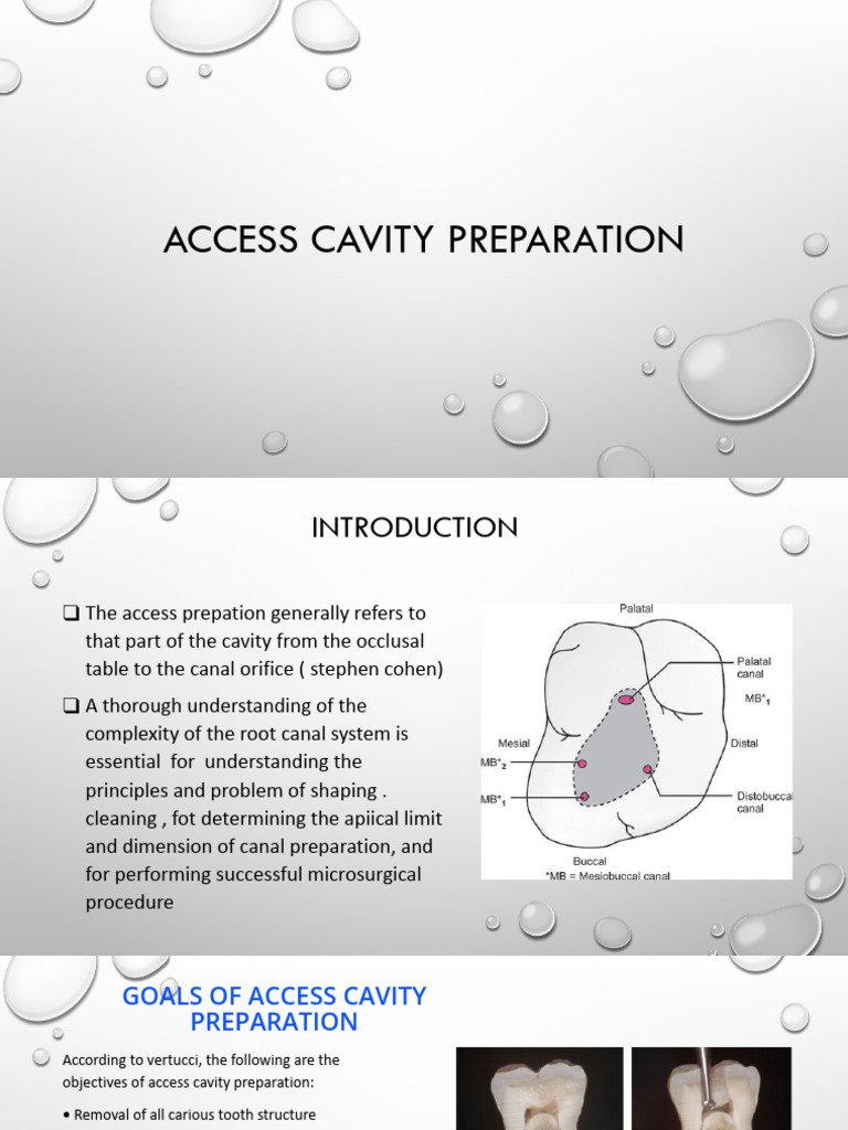Access Cavity Preparation Guide | PDF | Dentistry | Mouth