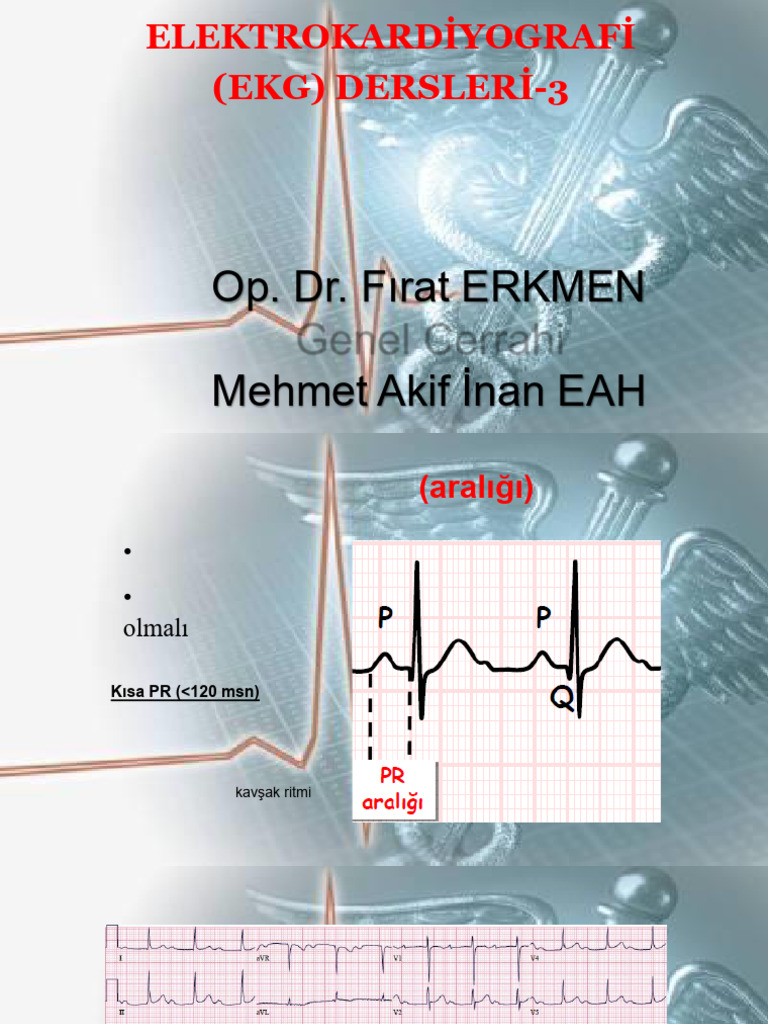 Ekg 3 | PDF
