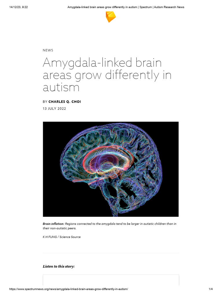 Amygdala-Linked Brain Areas Grow Differently in Autism - Spectrum ...