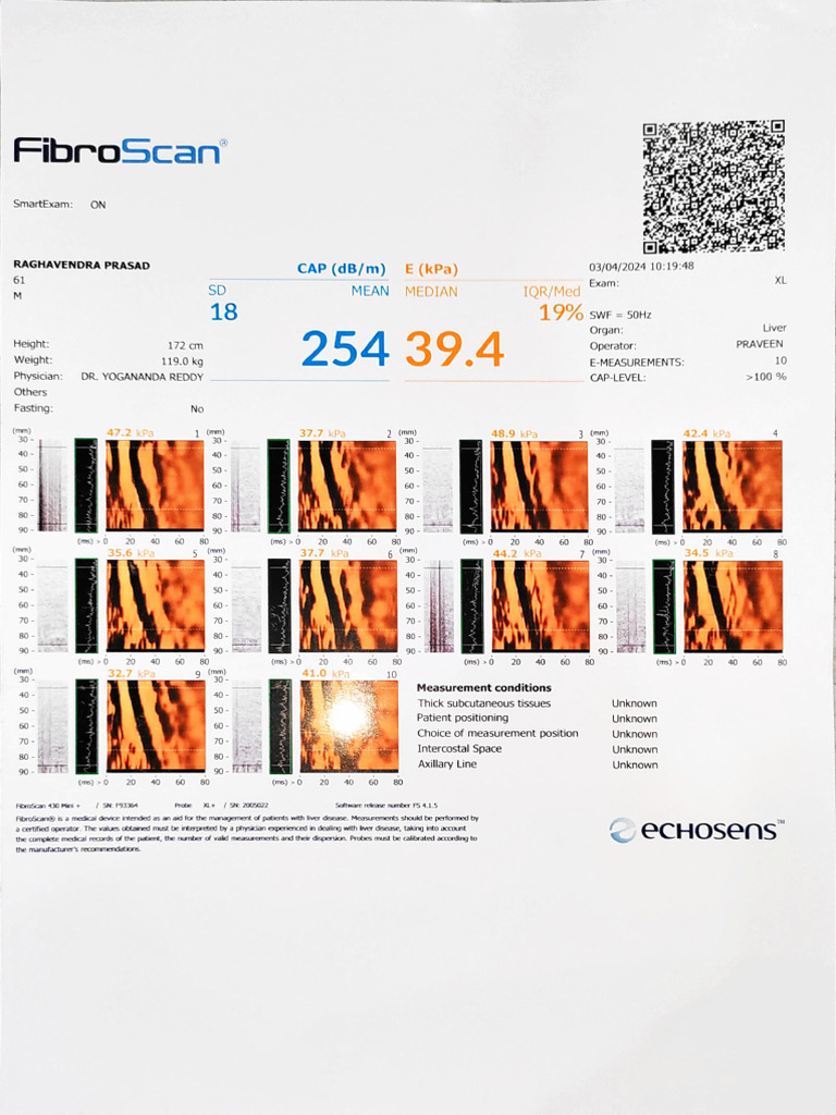 FibroScan | PDF