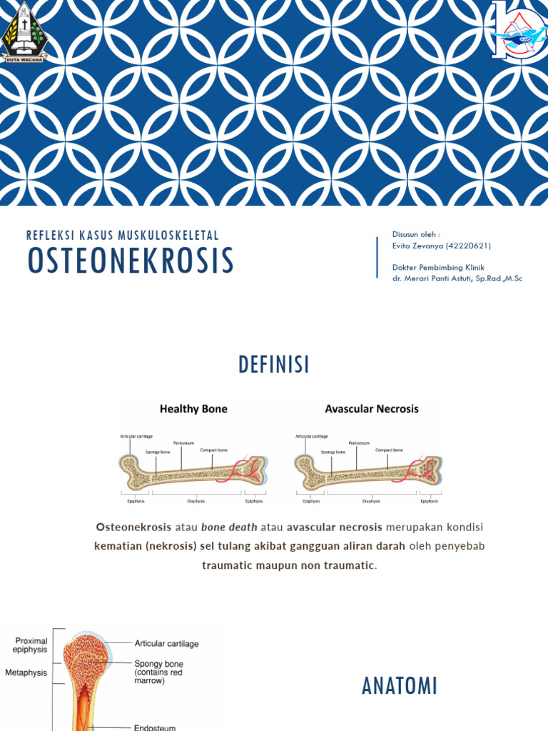 Osteonekrosis: Definisi dan Penanganan | PDF | Hip | Musculoskeletal System