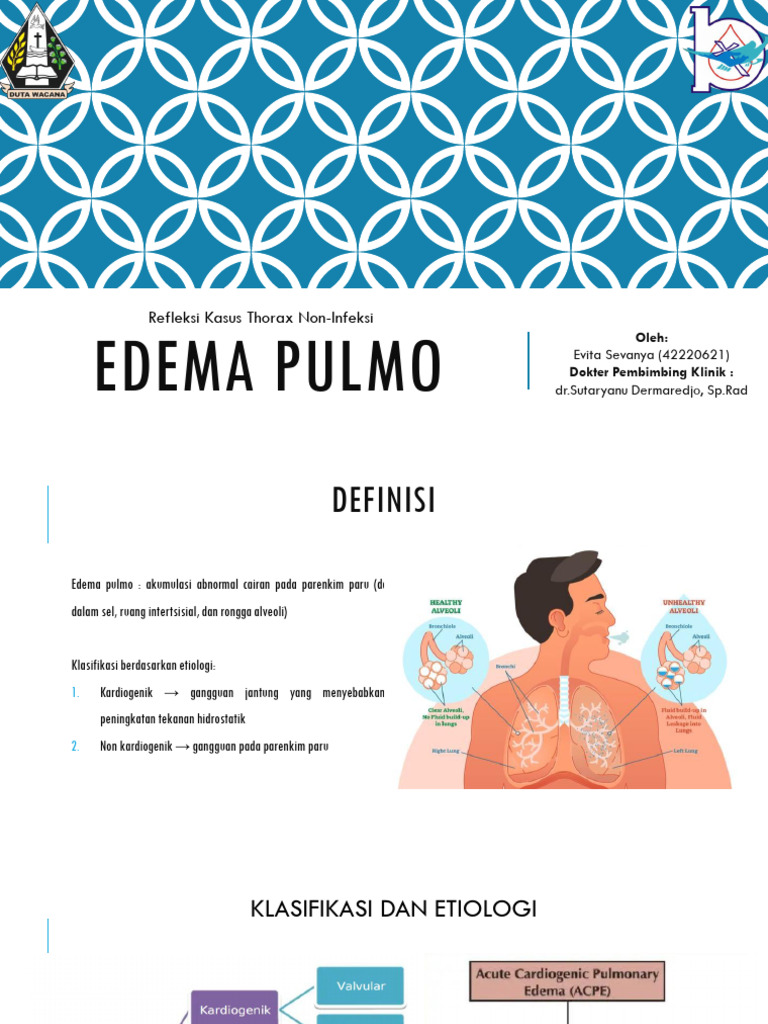 Radiologi Thorax Non-Infeksi : Edema Paru | PDF