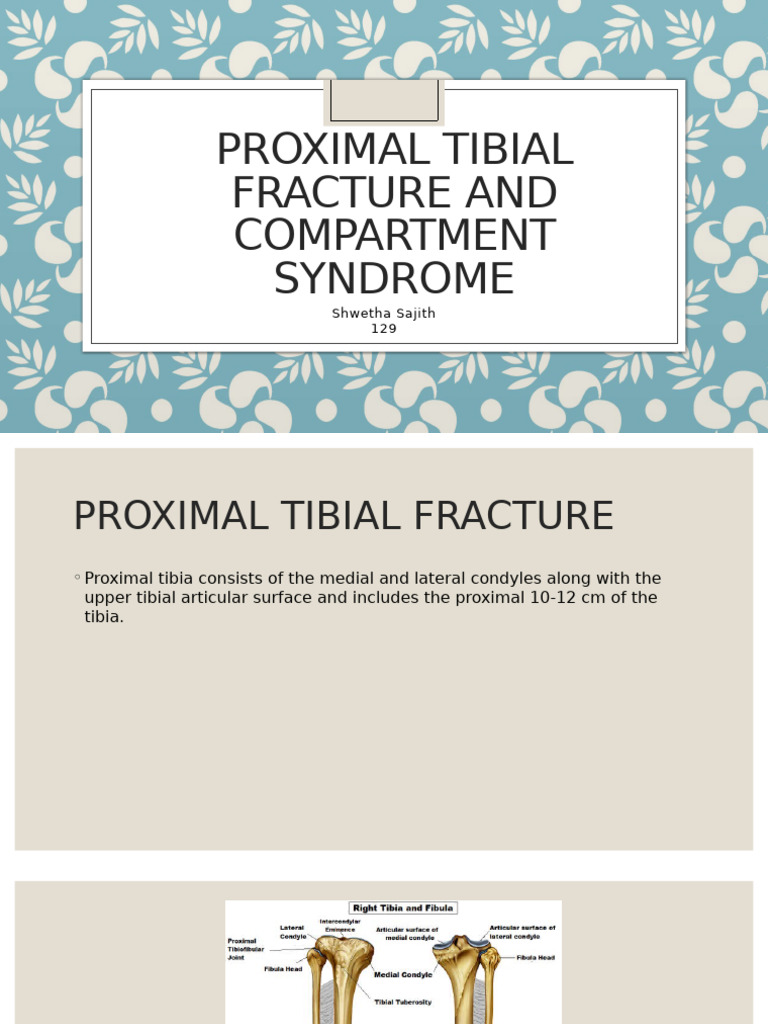Proximal Tibial Fracture | PDF | Knee | Musculoskeletal System