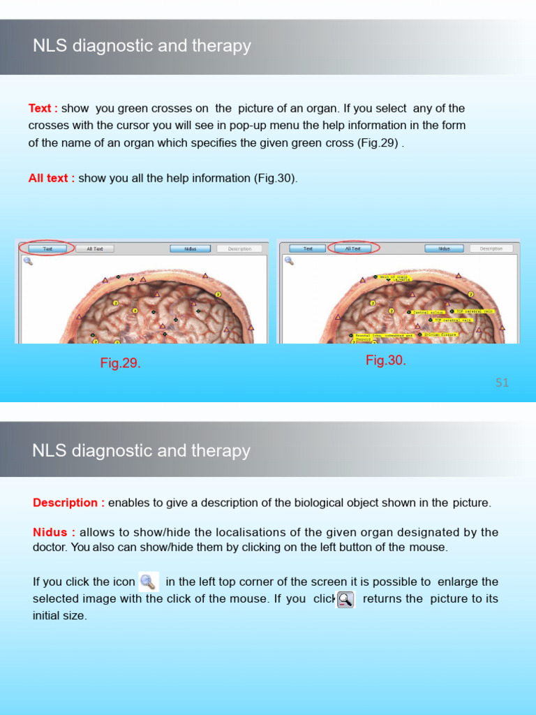 Bioplasm NLS Use ManualTraining 6 | PDF | Allergy | Stress (Biology)