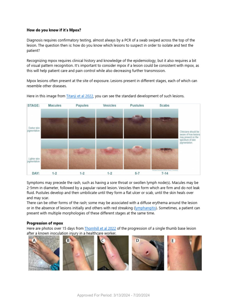 Mpox Training Form | PDF | Virology | Clinical Medicine