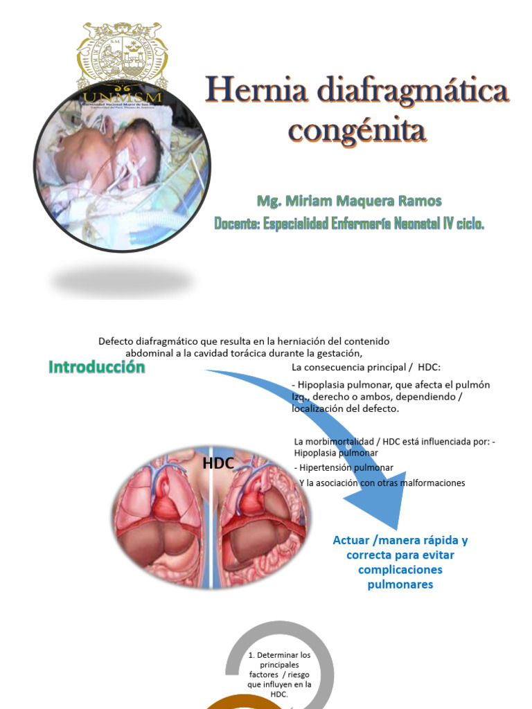 HDC | PDF | Pulmón | Abdomen