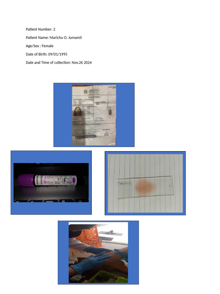 Patient Number 2 Finals | PDF