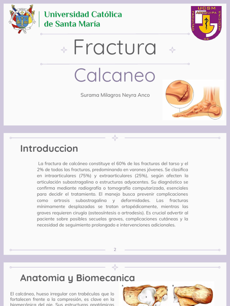 Fracturas de Calcáneo: Diagnóstico y Tratamiento | PDF | Pie | Hueso
