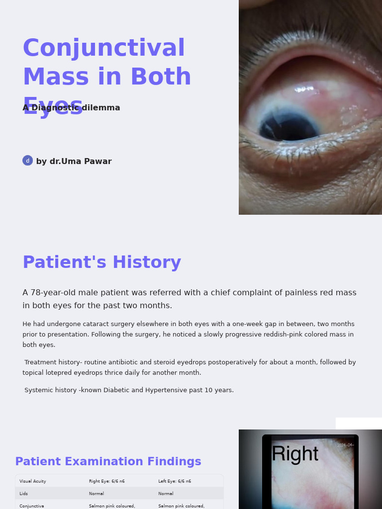 Conjunctival Mass in Both Eyes | PDF | Lymphoma | Medicine