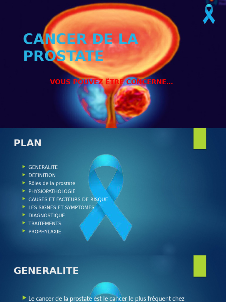 Comprendre le cancer de la prostate | PDF | Prostate | Cancer de la ...