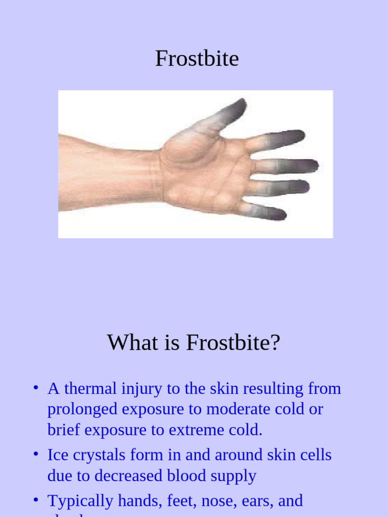 Frostbite 2002 | PDF