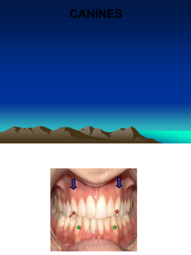 Permanent canines | PDF | Dental Anatomy | Tooth