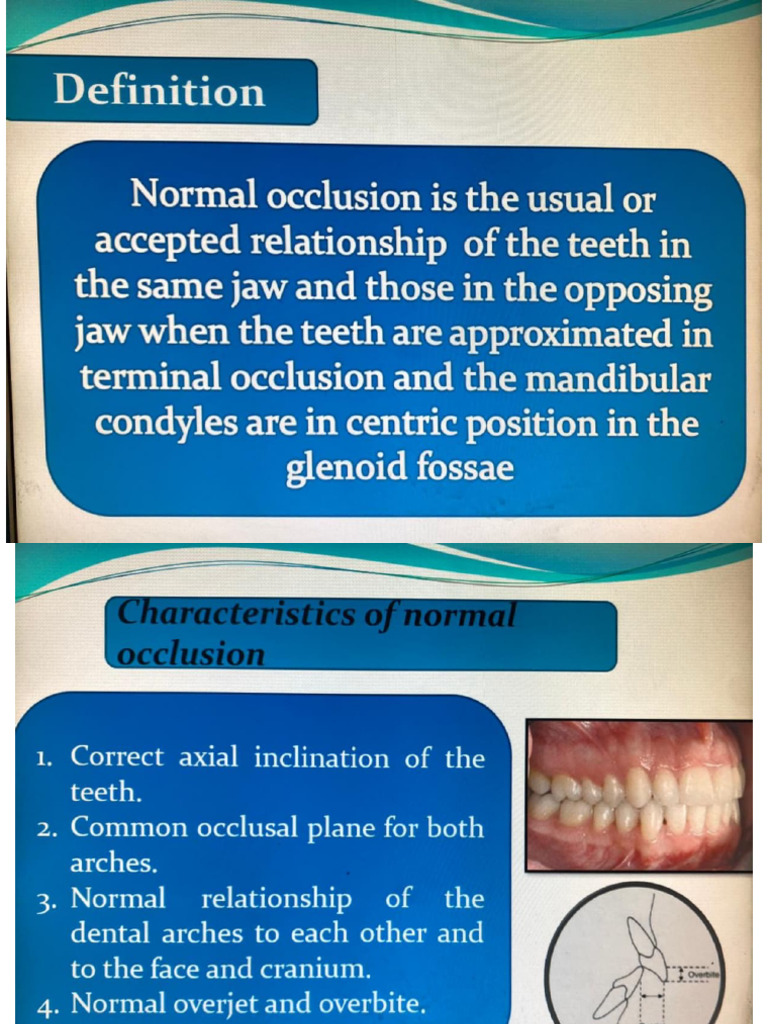 3 - 6 Keys of Normal Occlusion | PDF
