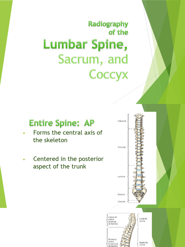 Lumbar Spine RAD1225 Spring (1) | PDF | Vertebra | Vertebral Column
