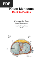 MRI Meniscus Tear Grading Guide | PDF