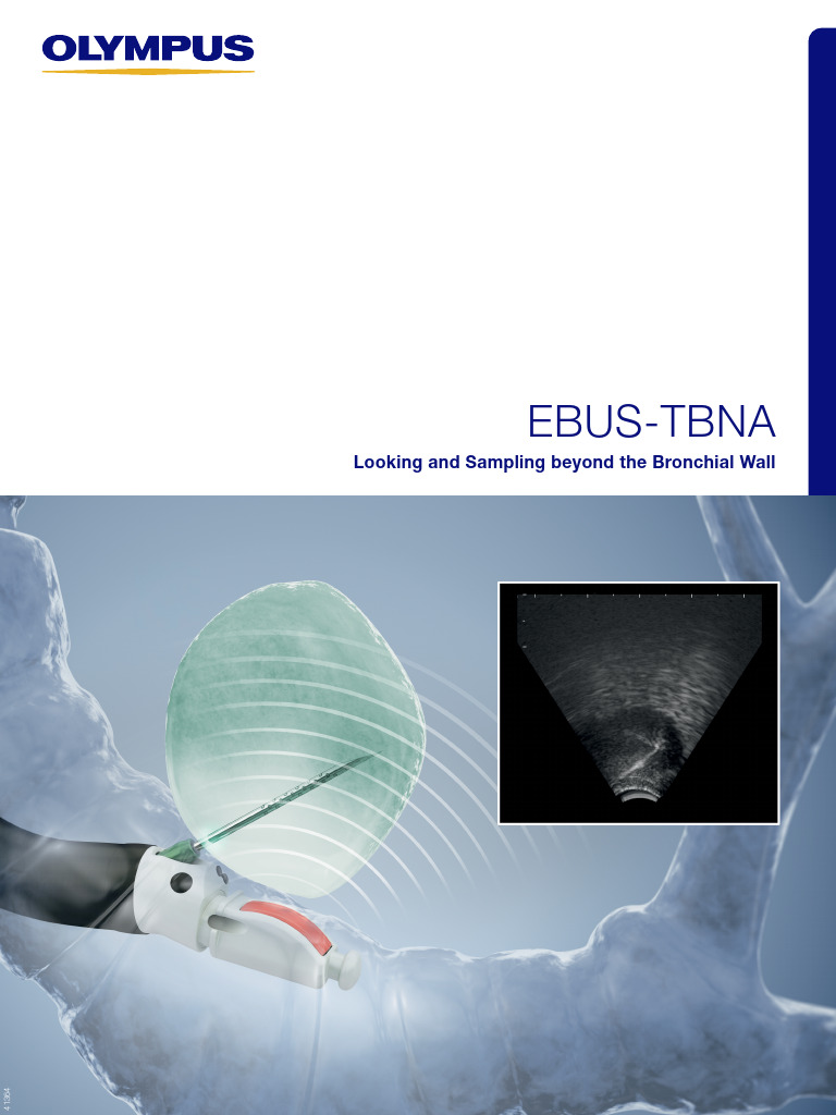 M00507EN_EBUS_TBNA_Brochure_A4_EN_V02_103564 | PDF | Medical Ultrasound | Pathology