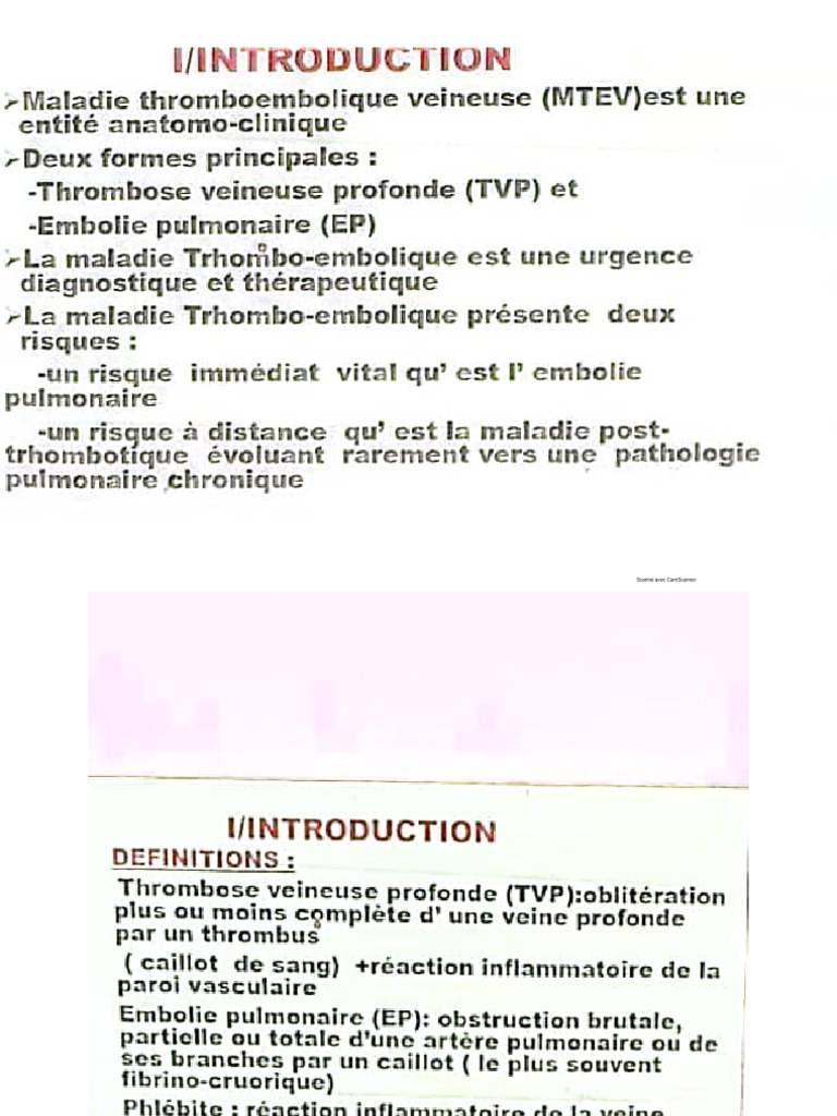 Maladie Thrombo-Embolique | PDF