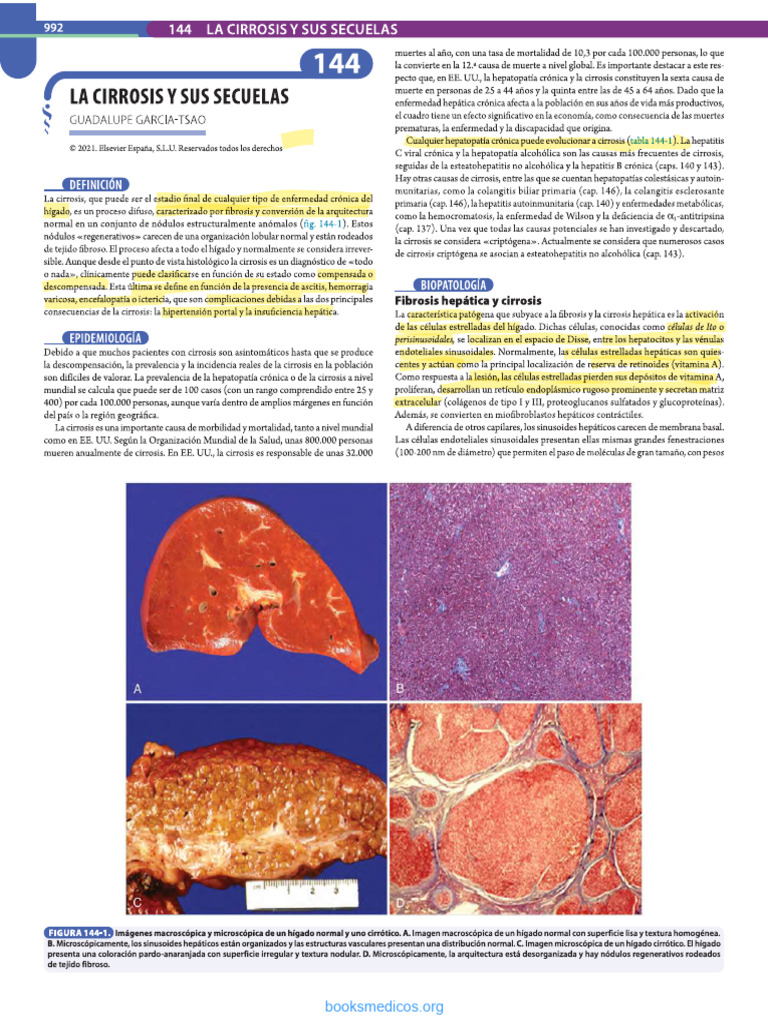 CIRROSIS | PDF